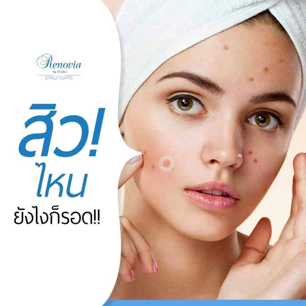One-Stop Acne Treatment – Fountain of Youth